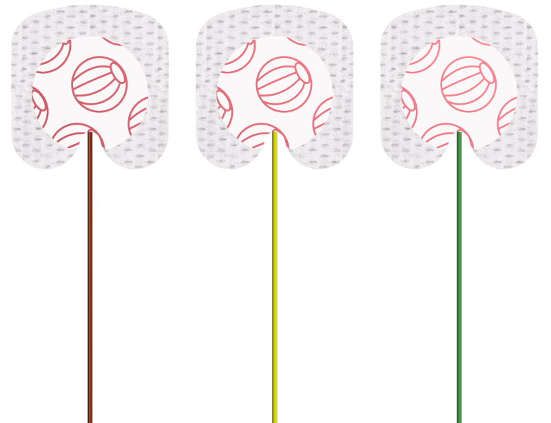 SKINTACT ECG Electrodes Children Neonates SKINTACT ECG Electrodes Children Neonates