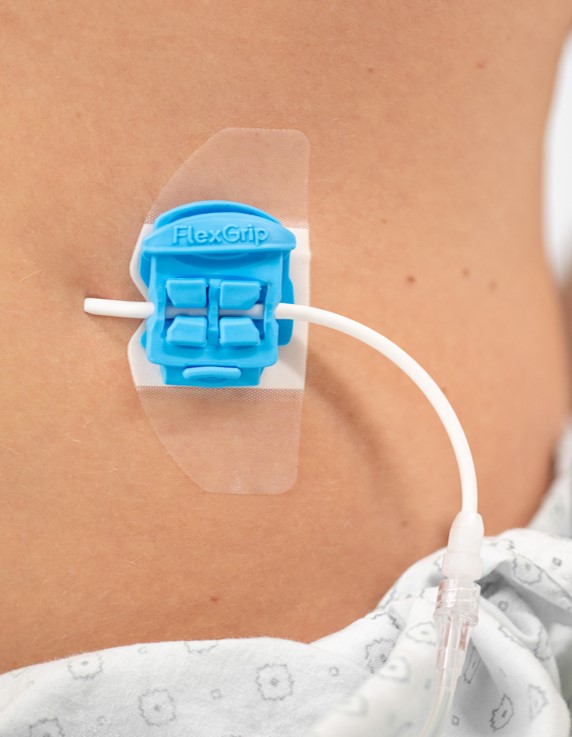 FlexGrip Universal fixator